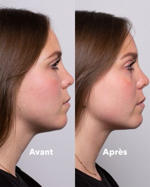 Modelage Methode Franca Renata , Maderotherapie